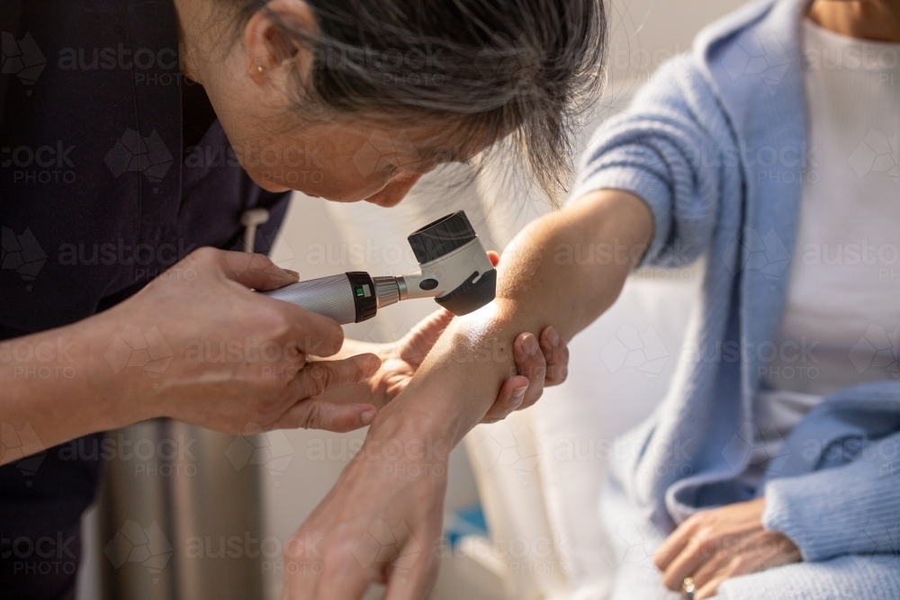 Image of Female healthcare worker using a dermatoscope to check female ...
