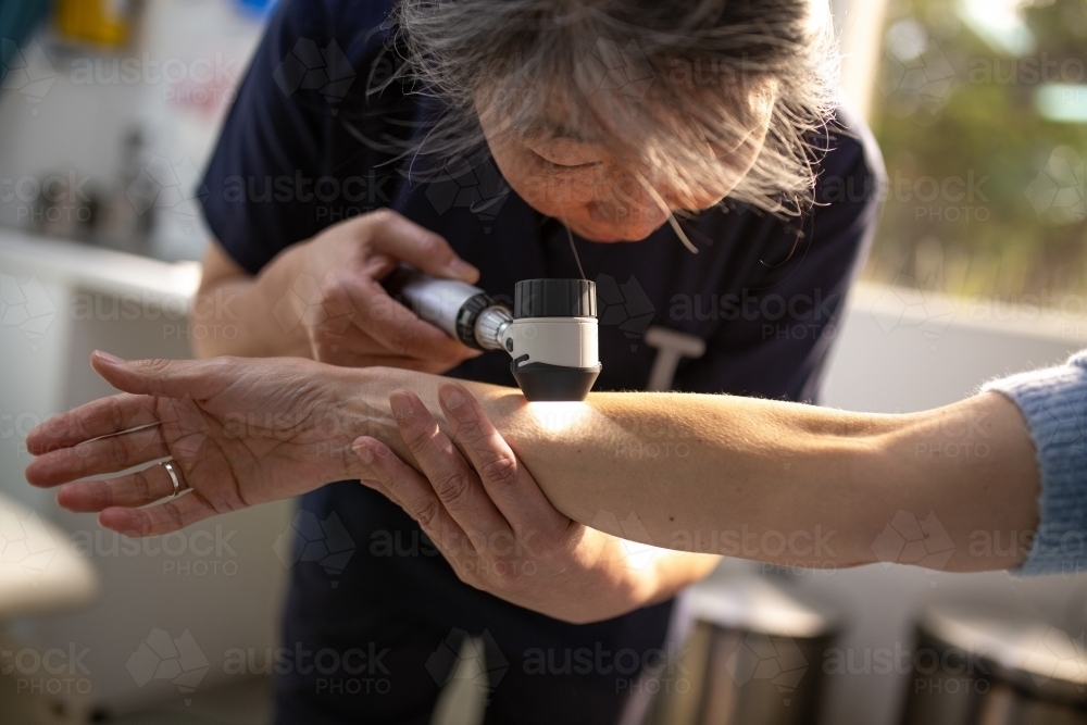 Image of Female healthcare worker using a dermatoscope to check female ...