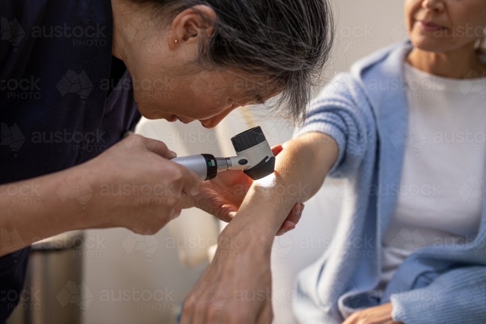 Image of Female healthcare worker using a dermatoscope to check female ...