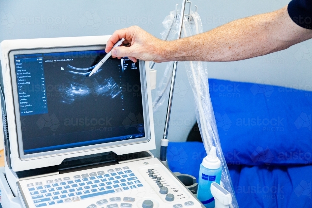 Image of Medical practitioner using an ultrasound machine - Austockphoto