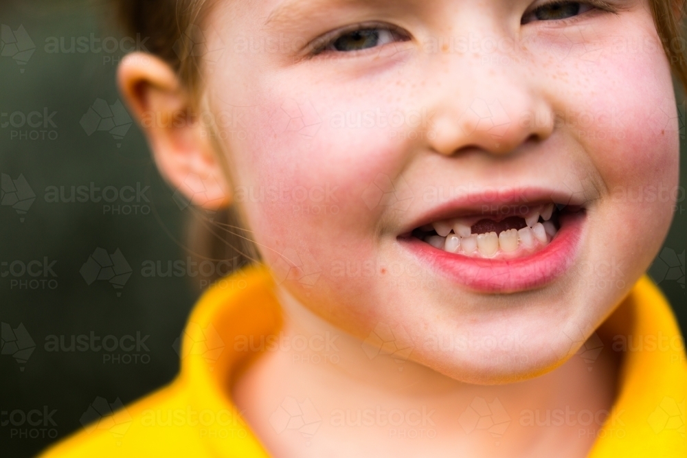 Image of young school girl showing her missing front teeth - Austockphoto